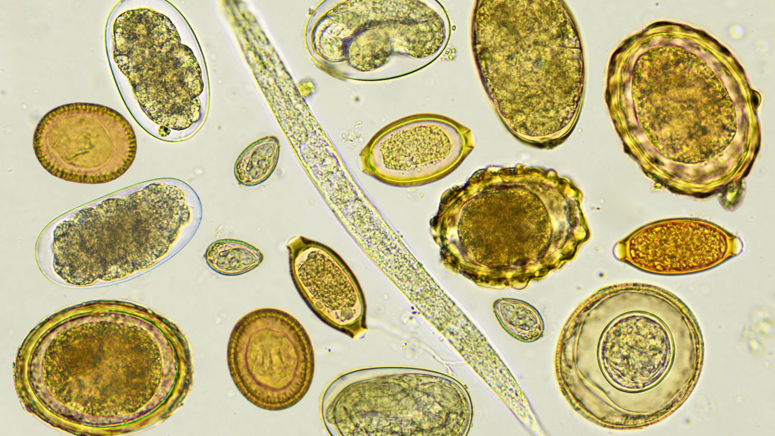 How To Recognize If You Have Parasites | Adventures of Frugal Mom